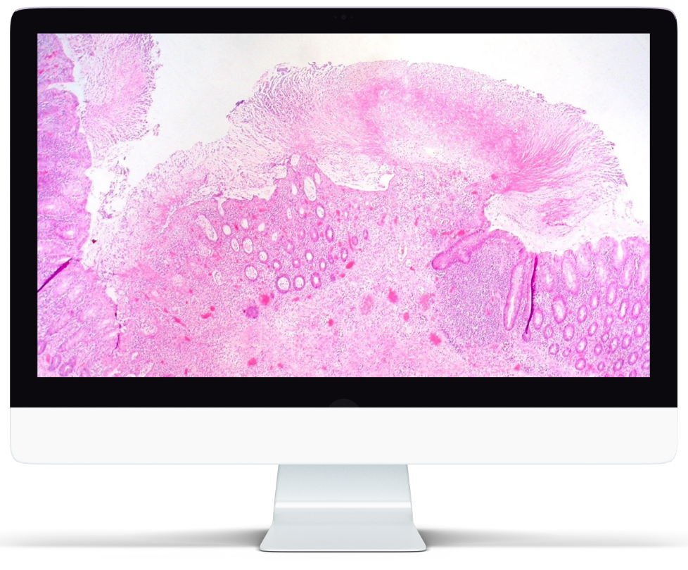 Logiciel d'aide au diagnostic médical : CaloPix analyse des images de ...