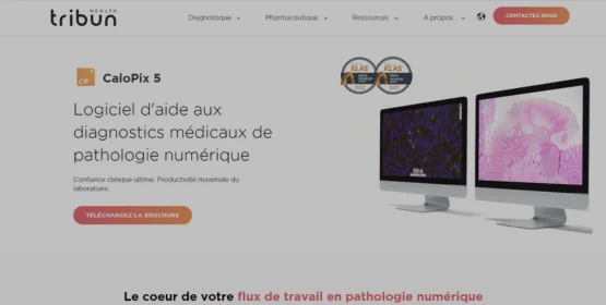 CaloPix : Logiciel d'aide au diagnostic médical | Tribun Health